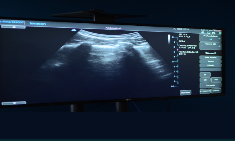 Treinamentos em Ultrassonografia Point of Care - You&Us